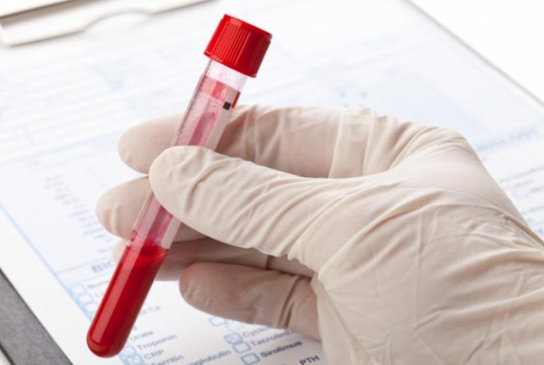 Test de cribado prenatal no invasivo como alternativa a la ...